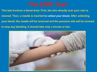 CRP test & ESR test | PPTX