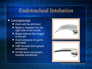 Cr pediatrics residents airway management part 2 | PPT