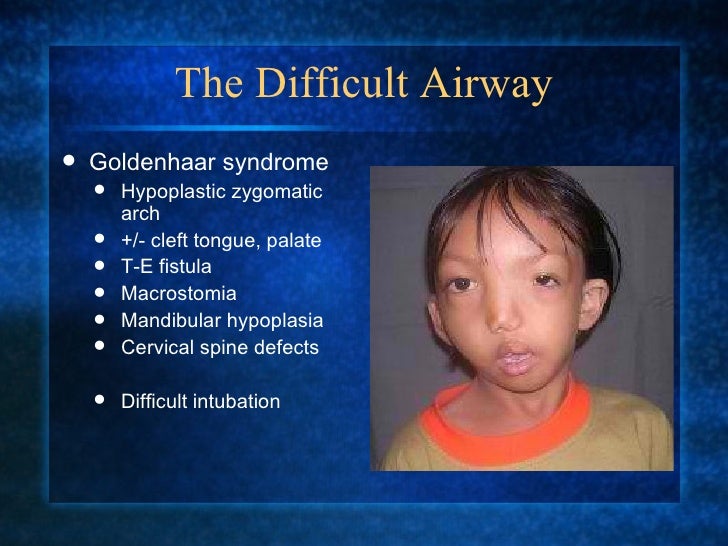 Cr pediatrics residents airway management part 2