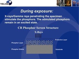 CR Presentation.ppt - Computed Radiography | PPT