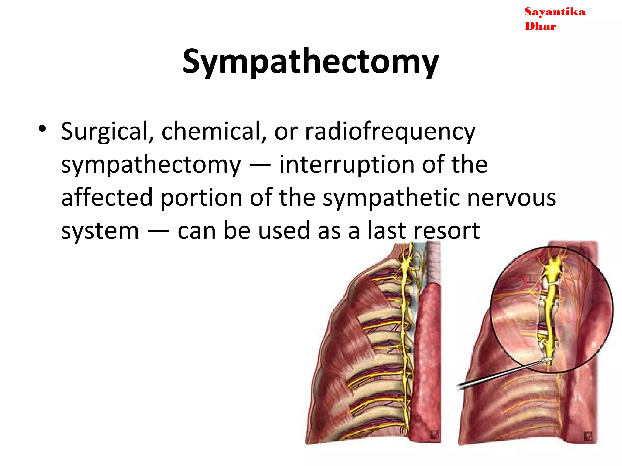 Reflex Sympathetic Dystrophy (CRPS 1) | PPT