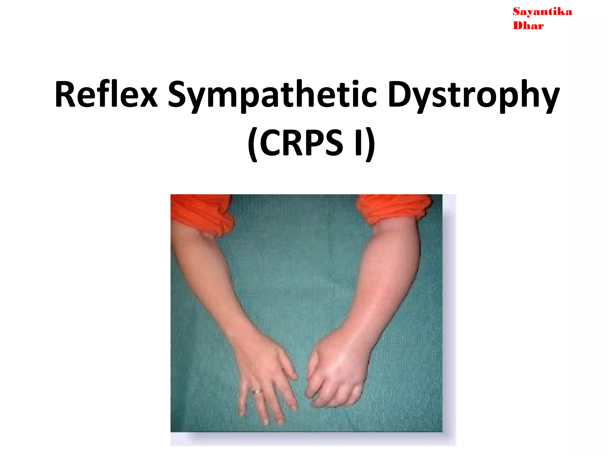CRPS I: Understanding Reflex Sympathetic Dystrophy Dhar | PPT