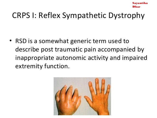 Reflex Sympathetic Dystrophy (CRPS 1)