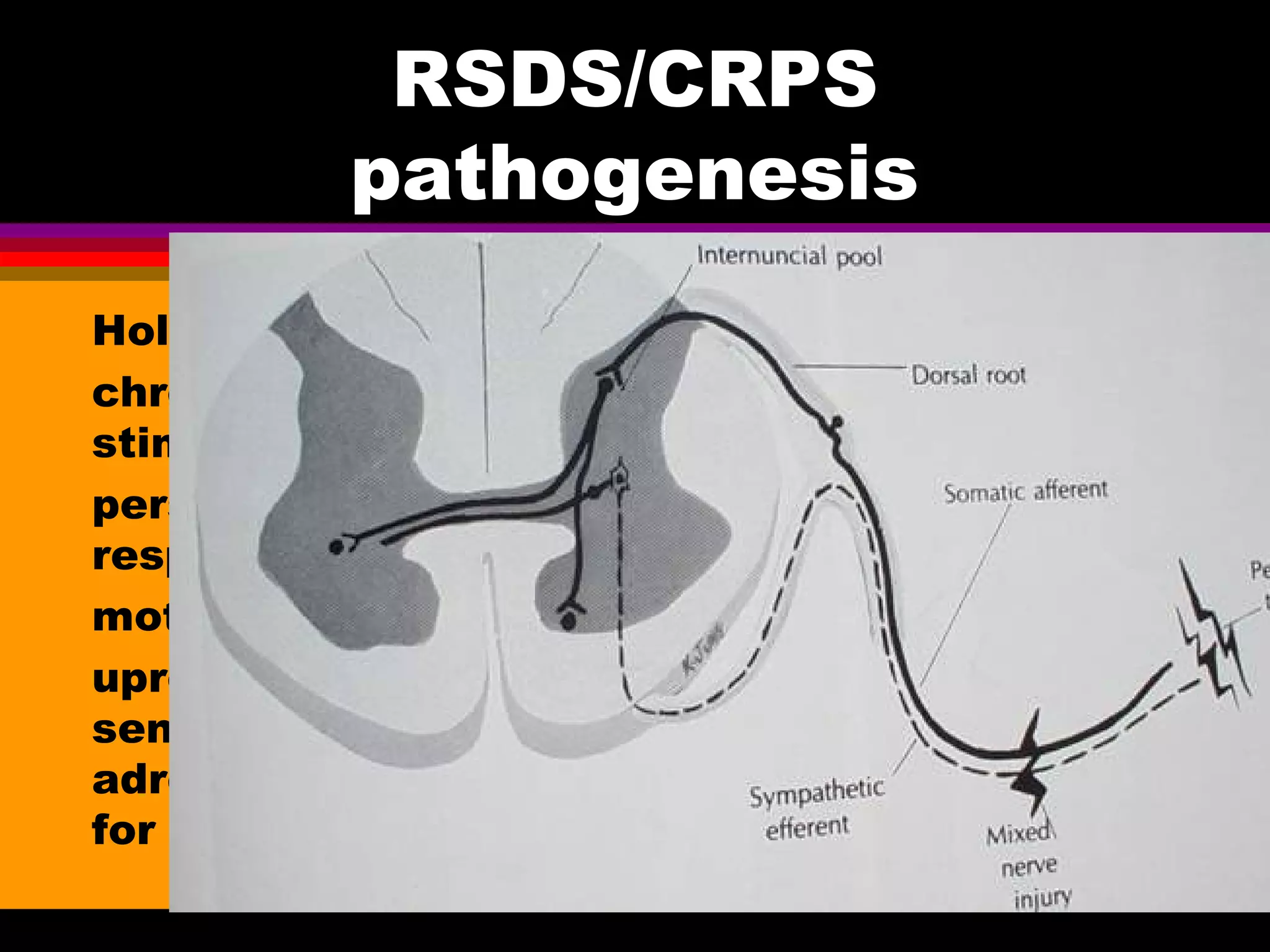 Crps | PPT | Physical Therapy | Wellness