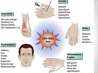 Crps | PPT