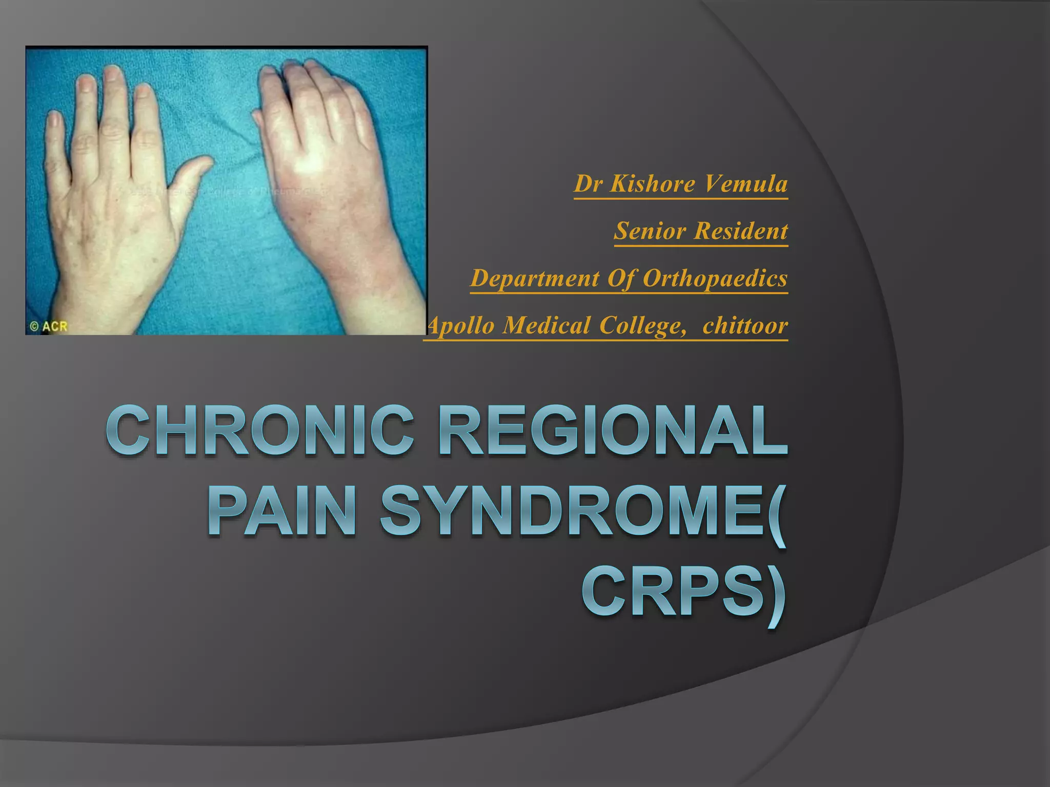 CRPS/ SUDECKS DYSTROPHY & MYOSITIS OSSIFICANS | PPTX