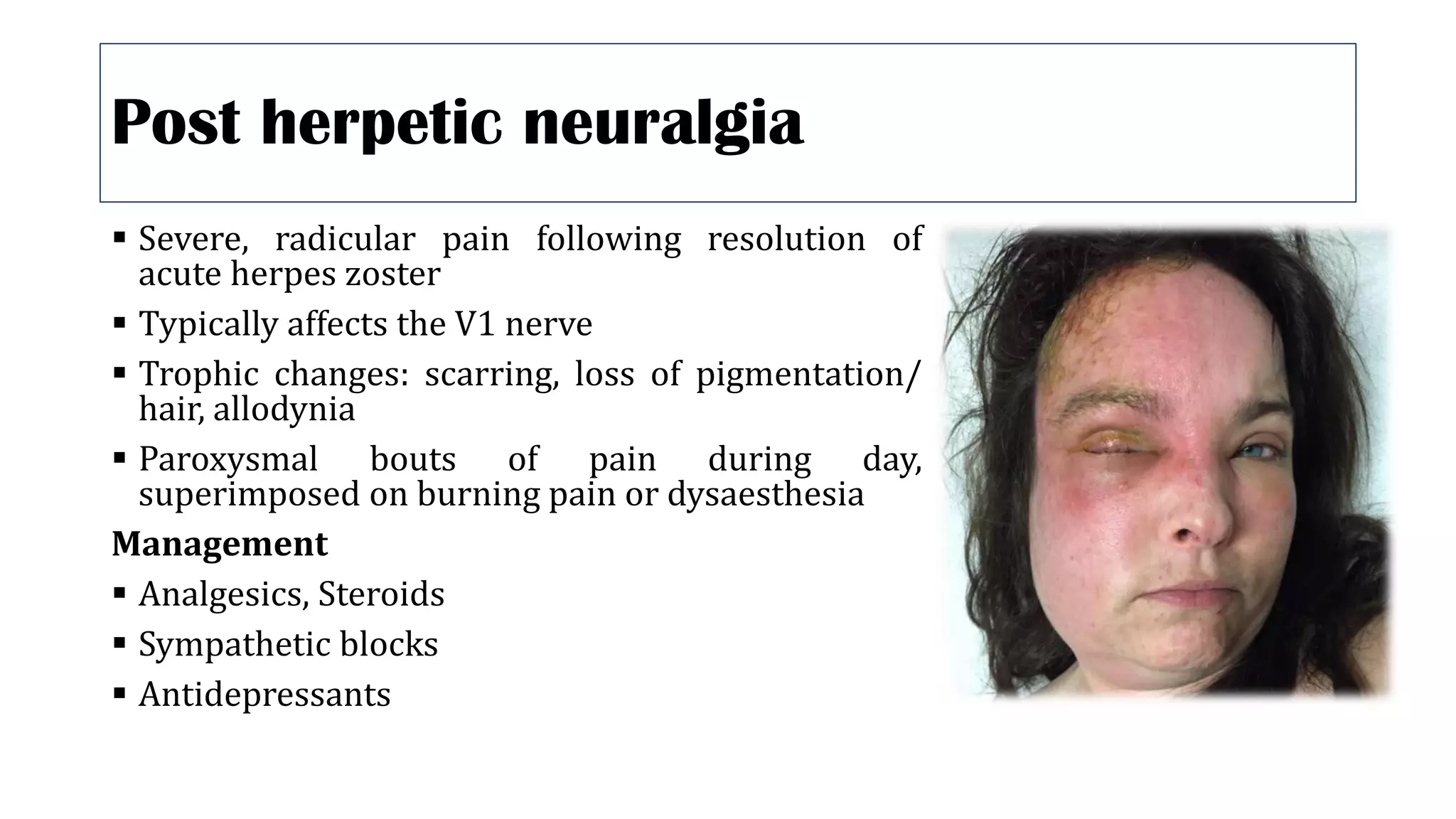 Complex Regional Pain Syndrome and other pain syndromes | PDF