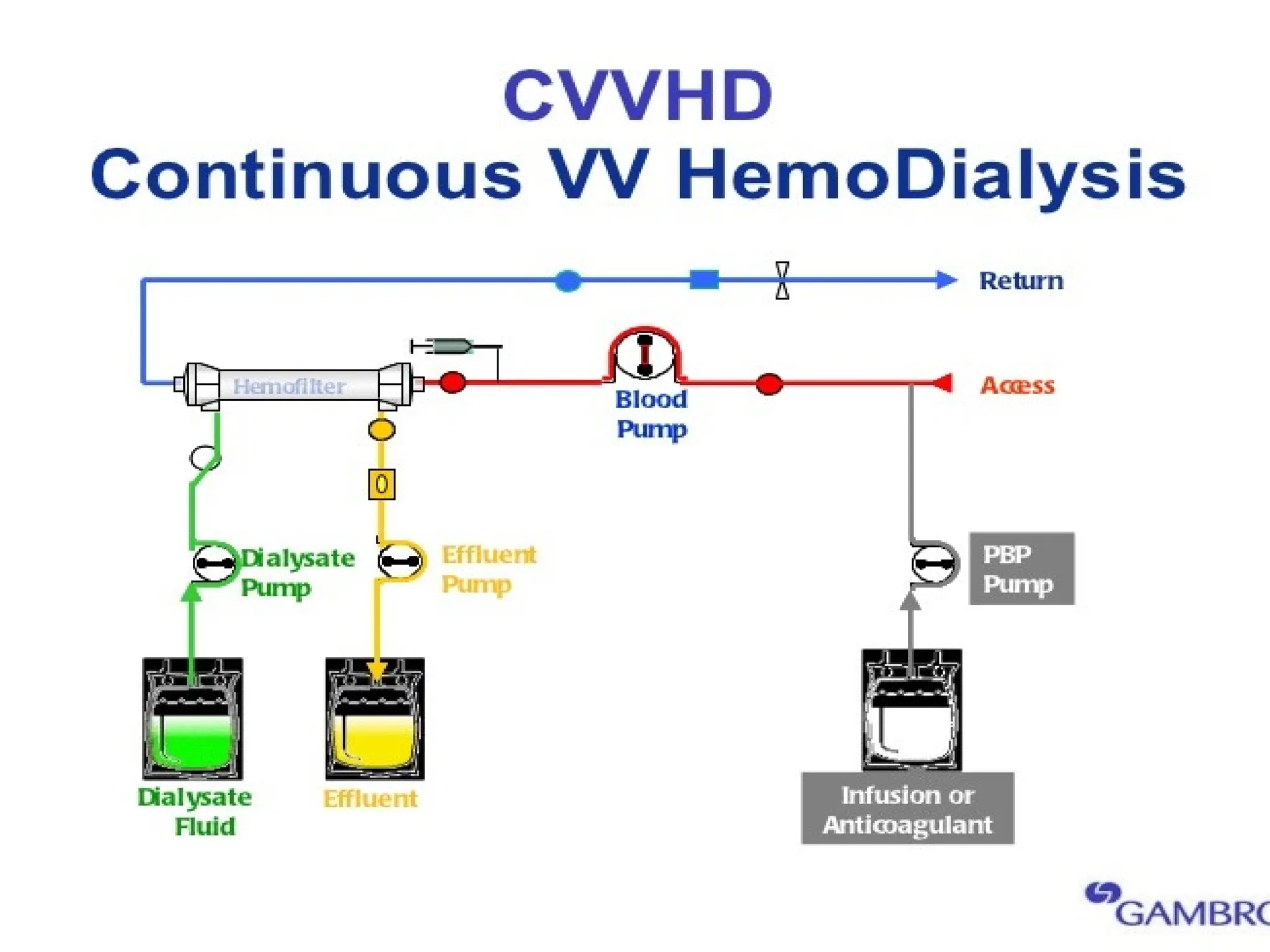 CRRT - Continuous Renal Replacement Therapy | PPTX
