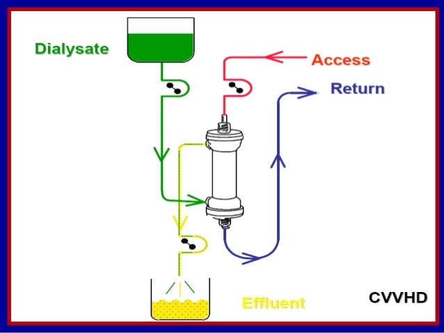 Continuous renal replacement therapy in icu Crrt 2