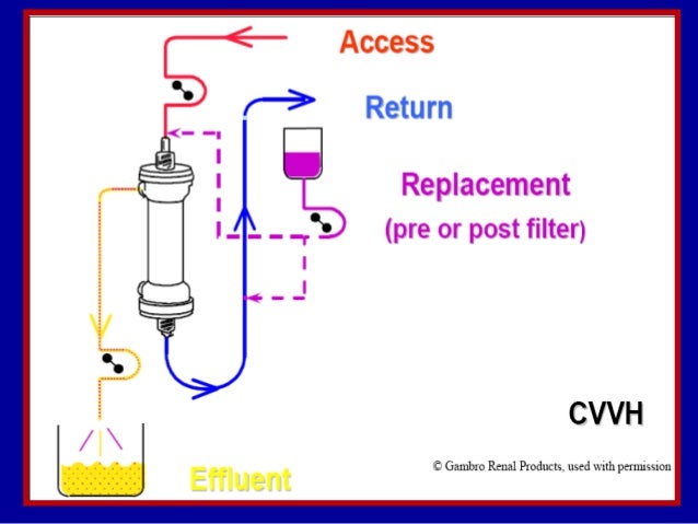 CONTINUOUS RENAL REPLACEMENT THERAPY Crrt 2