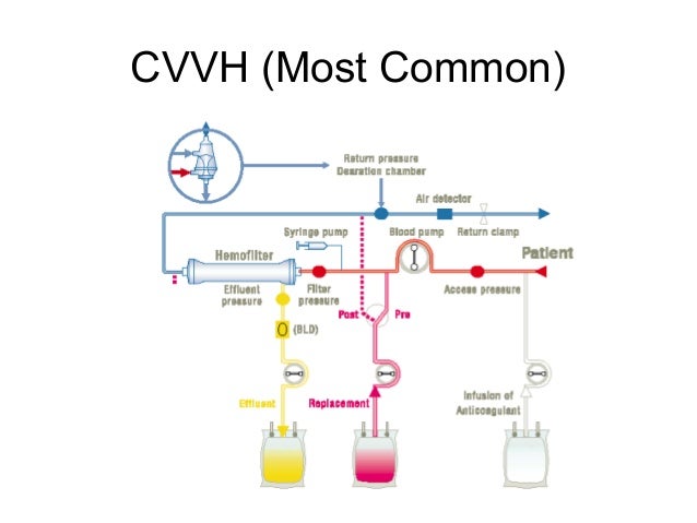 Crrt overview 1 26-13
