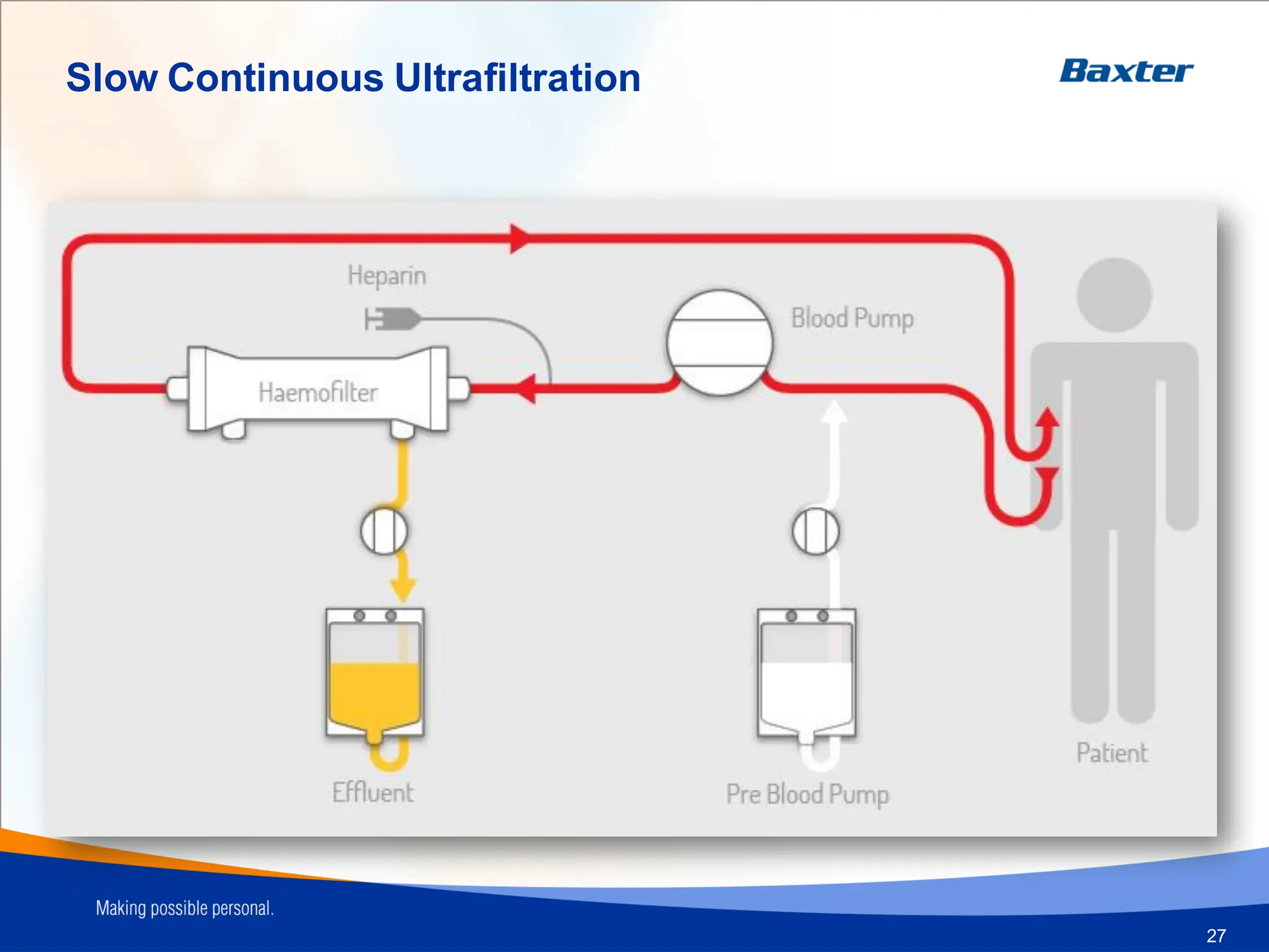 CRRT with Prismaflex slides renal replacement.pdf