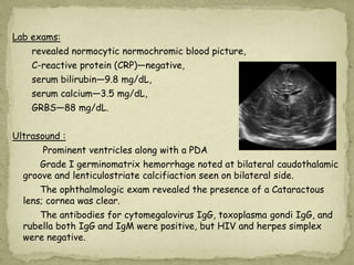 Congenital rubella syndrome | PPTX