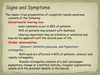 Congenital Rubella Syndrome