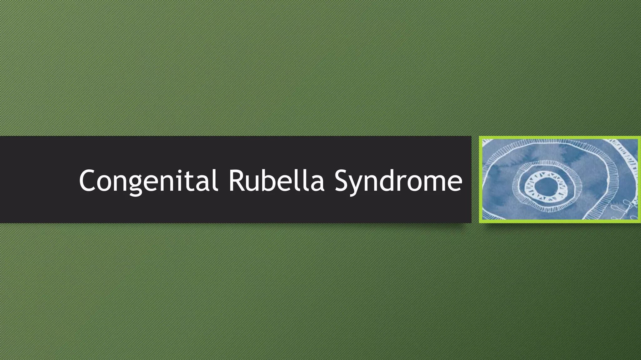 Congenital Rubella Syndrome | PPT