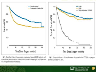 Hyperthermic Intraperitoneal Chemotherapy for Peritoneal Surface Malignancies | PPTX