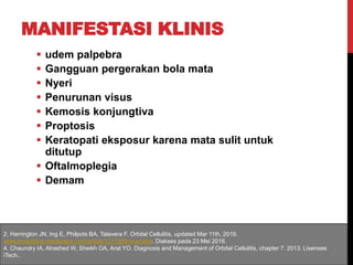 Crs selulitis orbita | PPTX