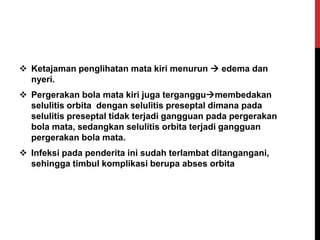 Crs selulitis orbita | PPTX