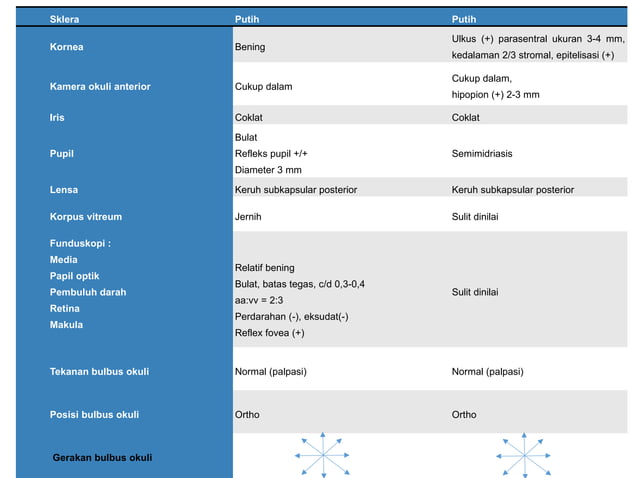CRS Ulkus Kornm mk,l,';.';.'..............ea.pptx