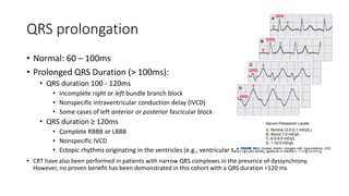 Cardiac Resynchronization Therapy and ICDs | PPTX