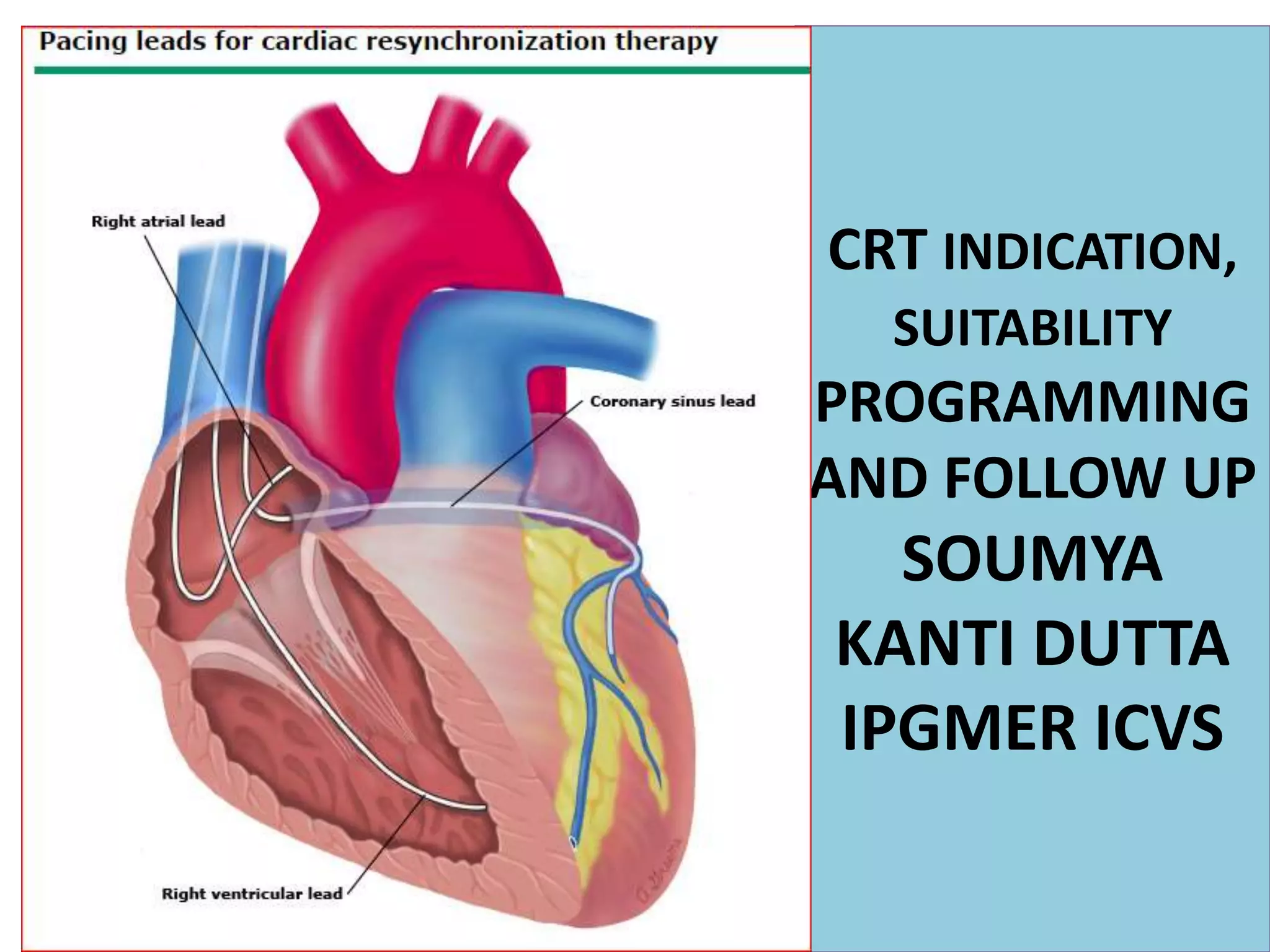 Crt indication, | PPTX