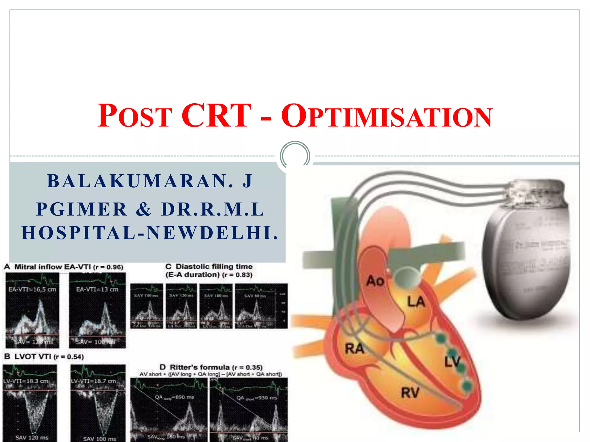 POST CRT OPTIMISATION | PPTX