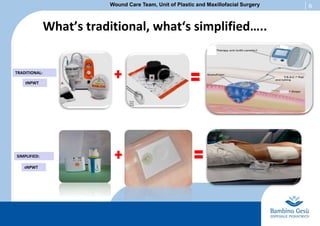 Simplified Canisterless NPWT in Children | PPT