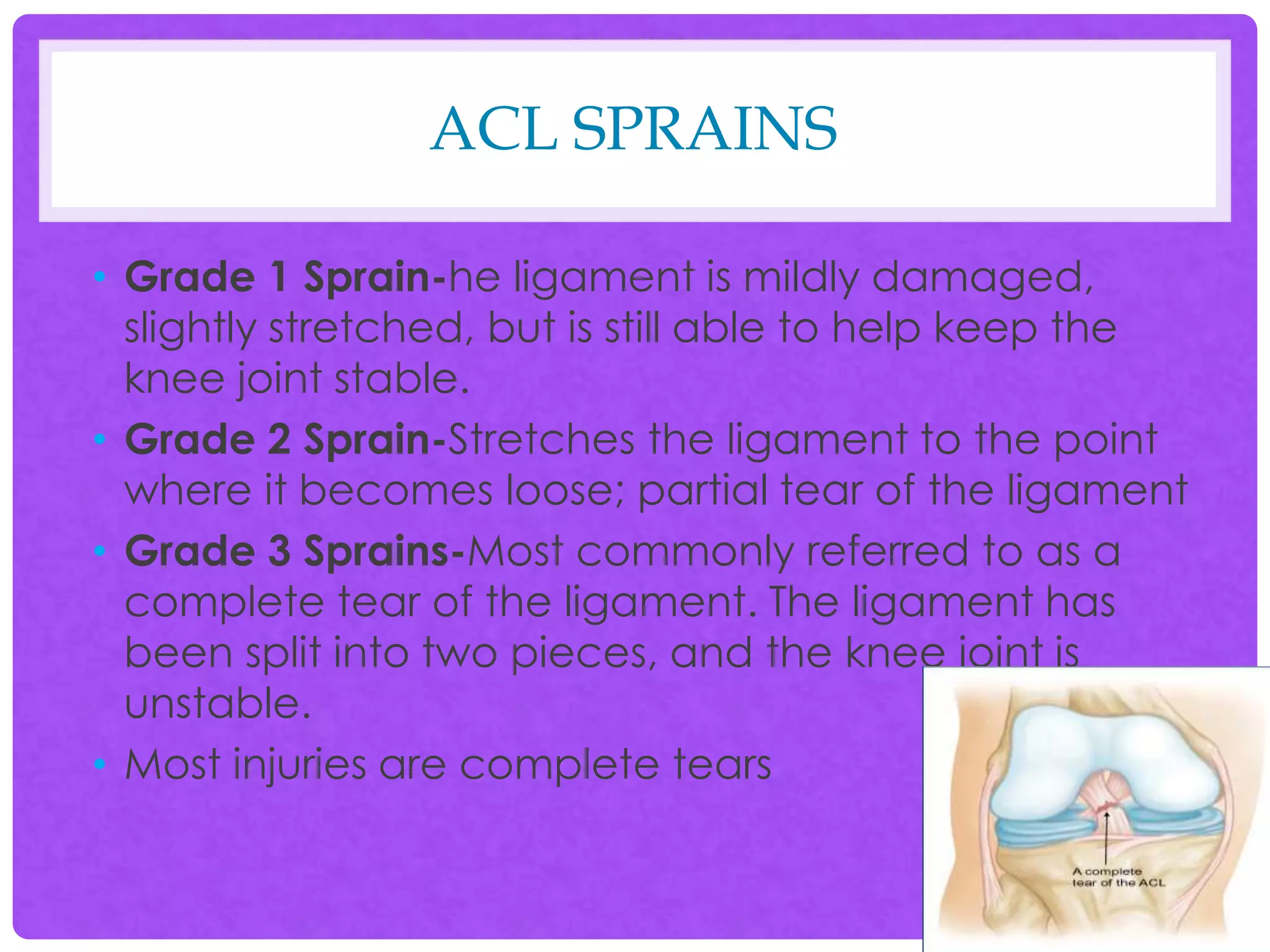 Anterior/Posterior Cruciate ligaments by Shannon Davis | PPTX