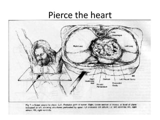 Roman Crucifixion Diagram