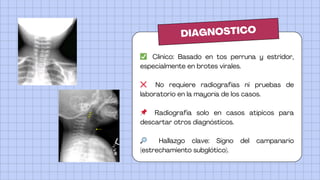 CRUP o laringotraqueitis aguda definición diagnóstico y manejo | PDF