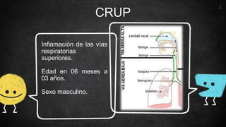 crup-johana-sanchez medicina pediatria.pptx