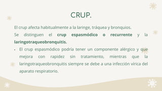 Crup pediatría | PPTX