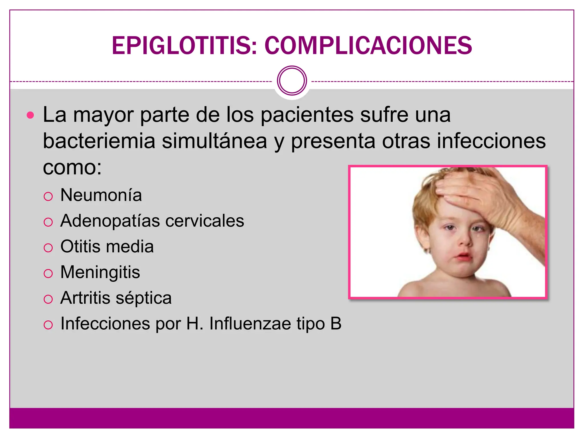Crup, Epiglotitis y CE.pdf pediatría lll | PPT