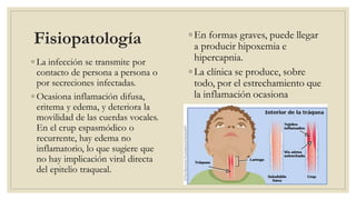 CRUP O LARINGOTRAQUEITIS AGUDA.pdfdassad | PDF