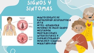 CRUP definición, epidemiologia, tratamiento y cuidados de enfermería | PDF