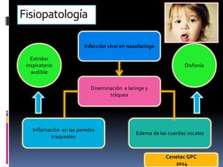 Crup viral | PPTX
