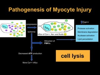 Crush injury-rhabdomyolysis | PPT
