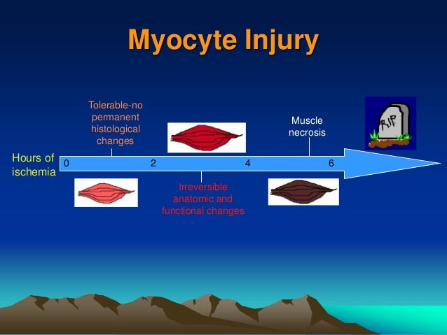Crush injuries and rhabdomyolysis