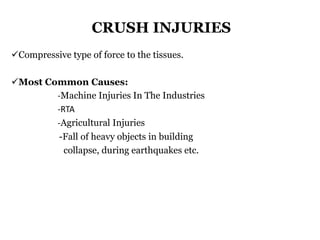 Crush injuries of hand | PPTX
