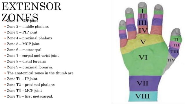 CRUSH INJURIES OF THE HAND.ppt