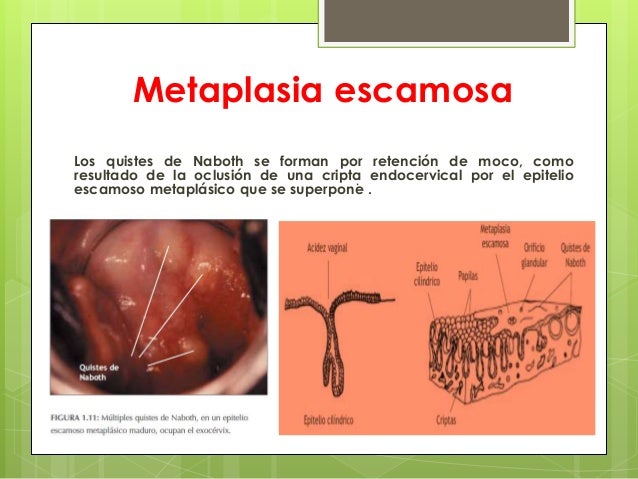 Ginecología: Cuello del útero, introducción