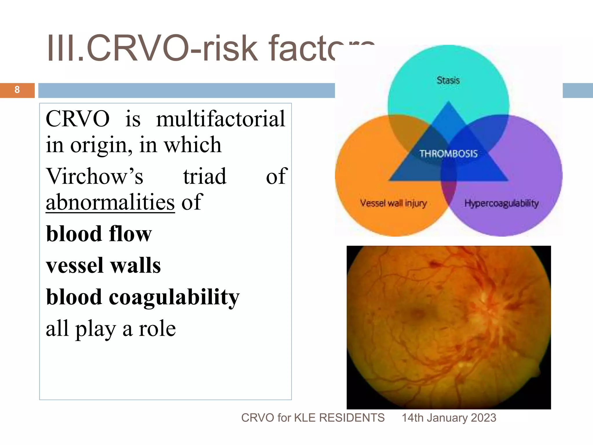 DR WANI'S TALK ON CRVO FOR RESIDENTS KLE 14 JAN 2023.pptx | Eye and ...