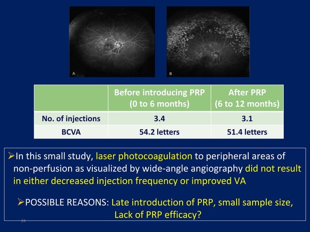 Crvo management -AJAY DUDANI | PPTX | Eye and Vision Conditions ...