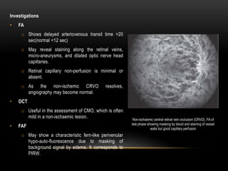 Crvo seminar final | PPTX