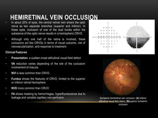 Crvo seminar final | PPTX