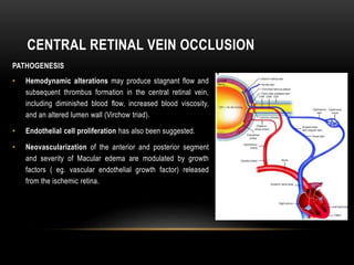 Crvo seminar final | PPTX