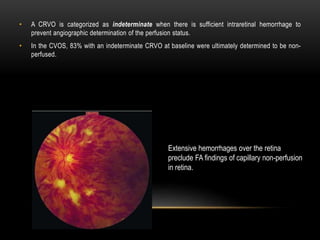 Crvo seminar final | PPTX