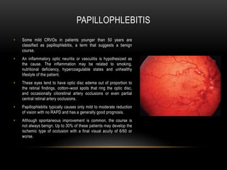Papillophlebitis