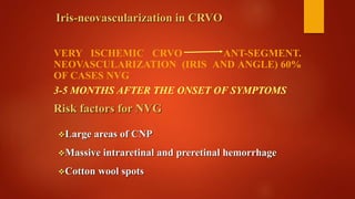 CRVO | PPTX | Eye and Vision Conditions | Diseases and Conditions