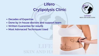 Crylipolysis Treatment | PDF